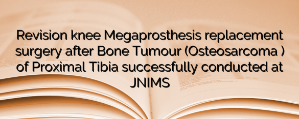 Revision knee Megaprosthesis replacement surgery after Bone Tumour ...
